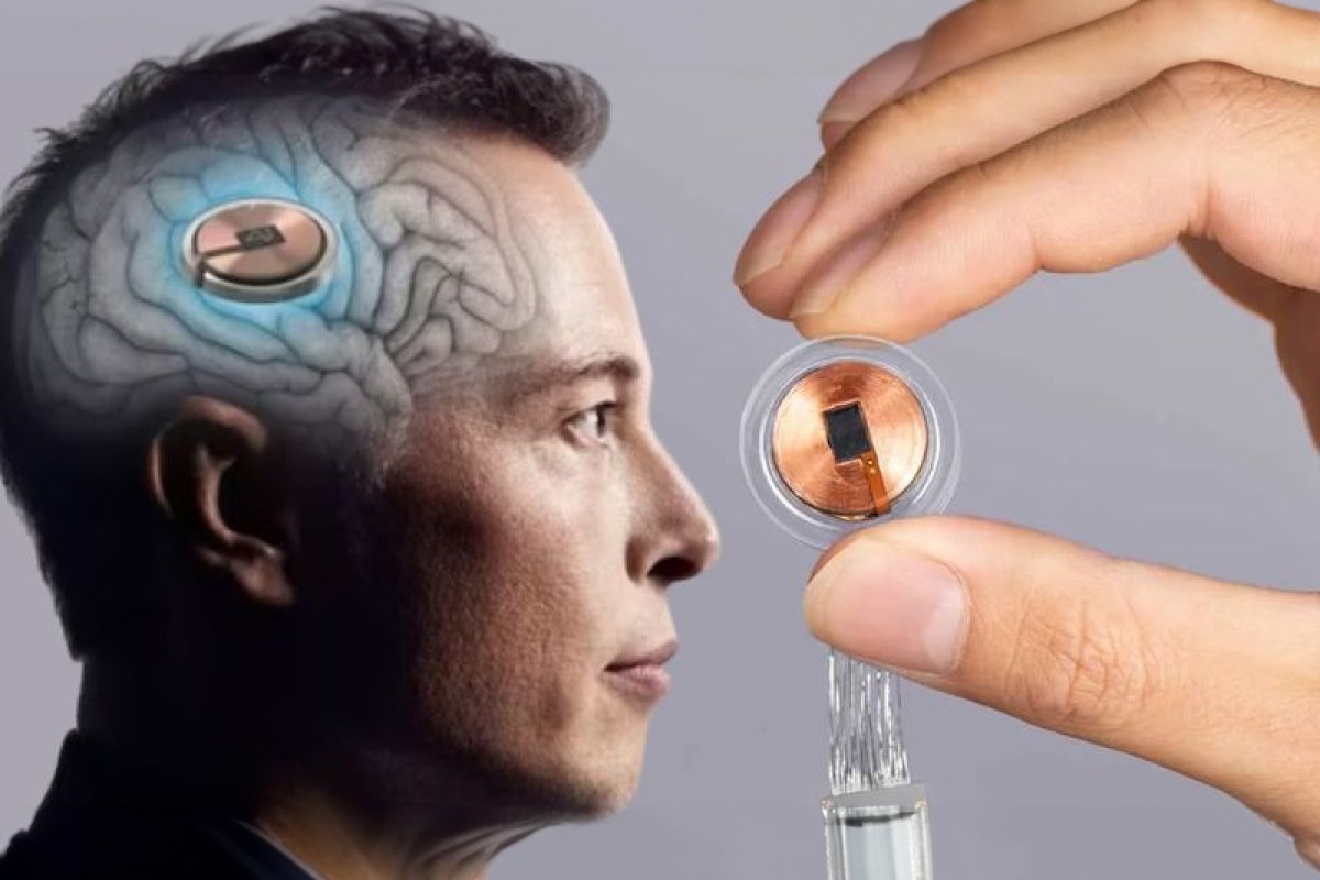 Elon Musk has lost control and plans to implant thousands of brain ...