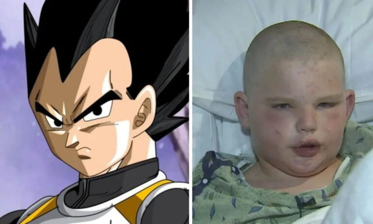 Aos 11 anos, menino atacado por 400 abelhas africanas lembra de Vegeta ...
